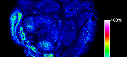Overview | Proteomics Core | Albert Einstein College of Medicine ...