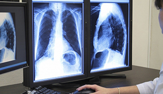 Home | Montefiore-Einstein Division of Pulmonary Medicine | Albert ...