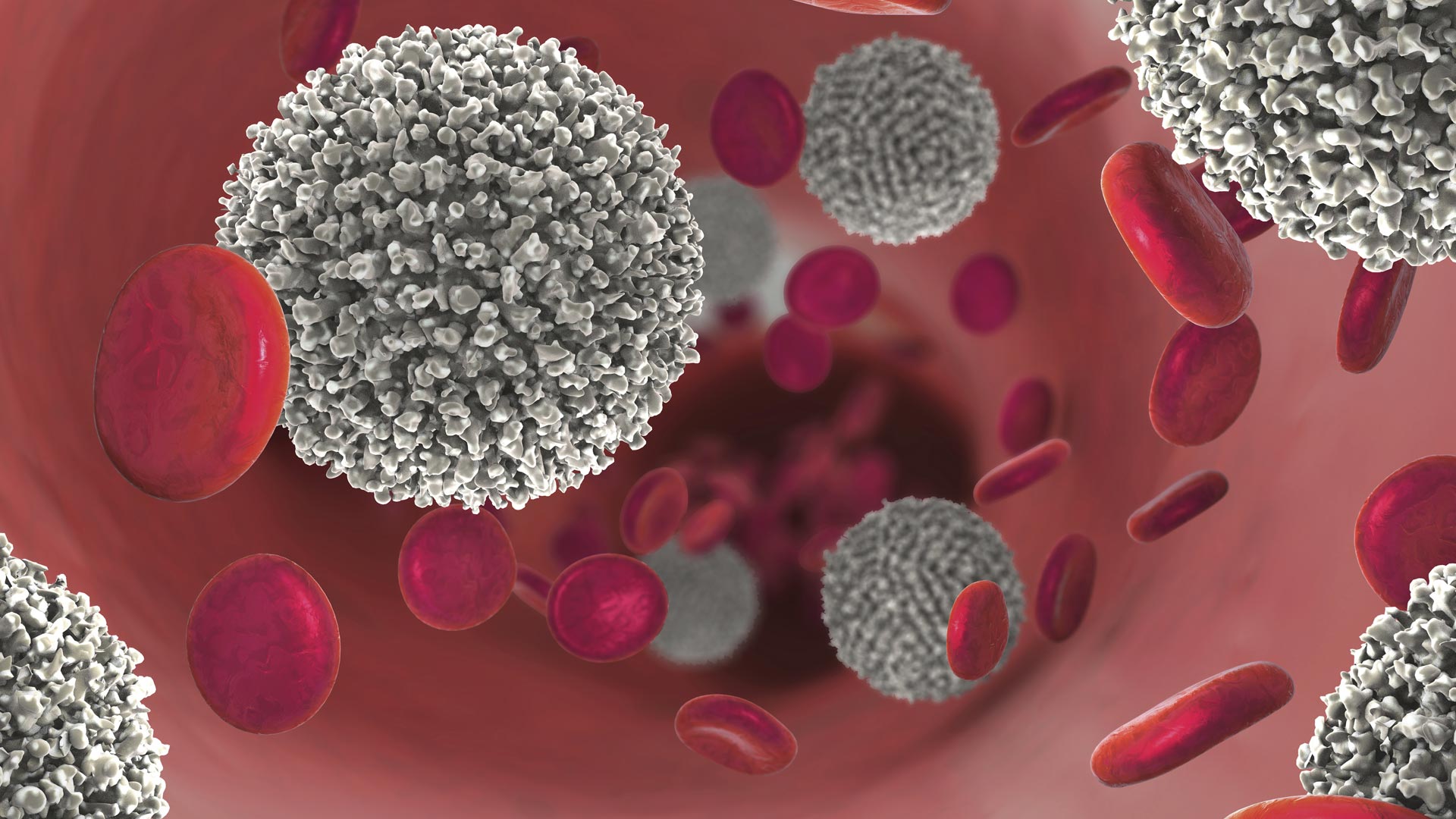 Progress in Understanding and Preventing Blood Cancer | Newsroom ...