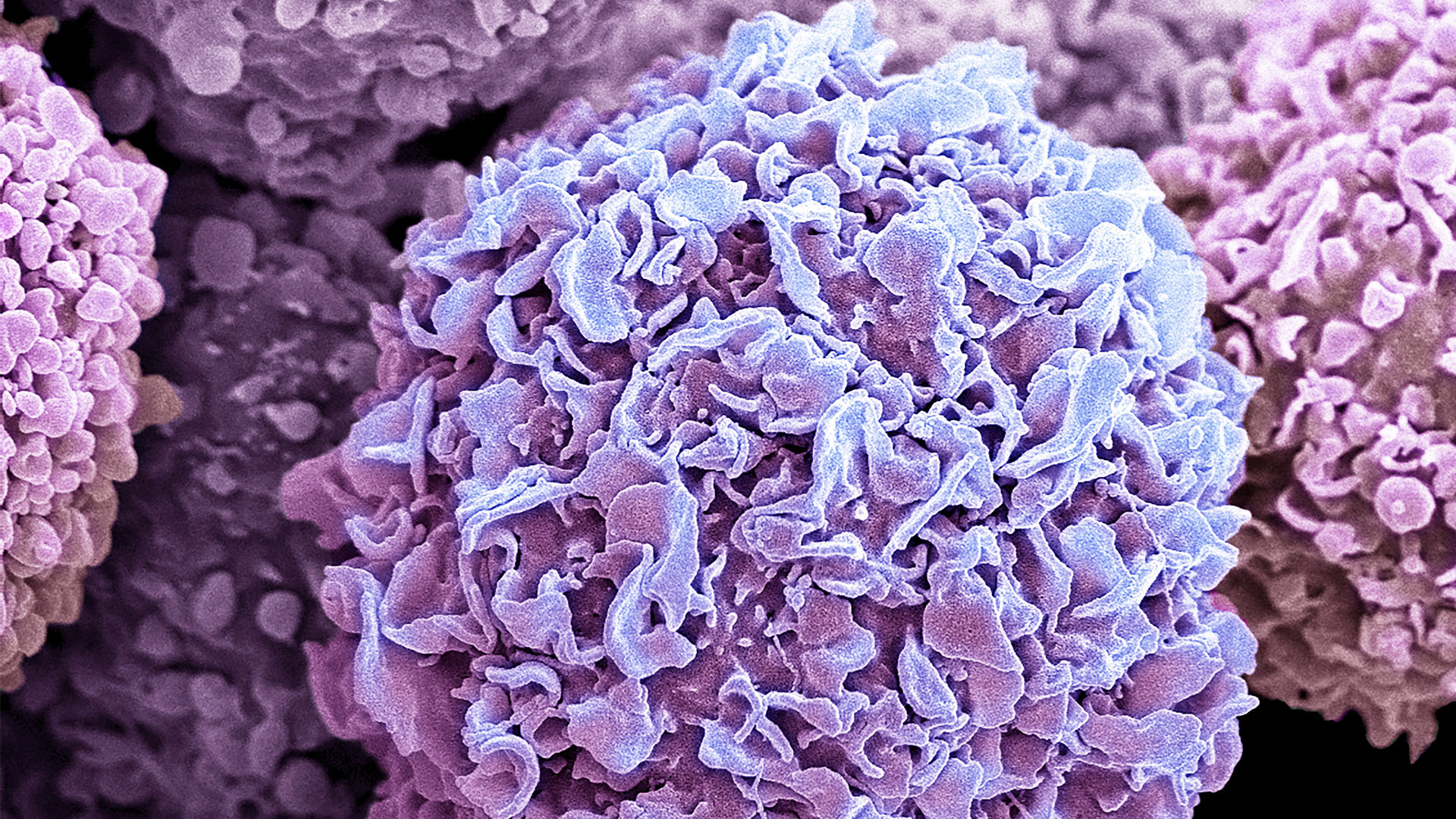 Overview | Department of Cell Biology | Albert Einstein College of Medicine