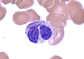 Research | The Verma Laboratory | Albert Einstein College of Medicine ...