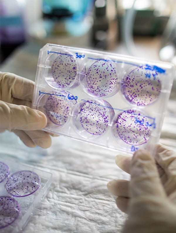 Research | Albert Einstein College of Medicine