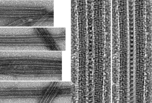 TEM Gallery | Analytical Imaging Facility | Albert Einstein College of ...