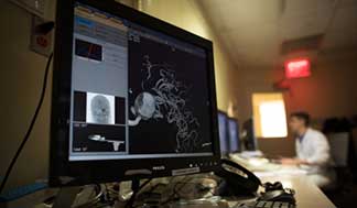 Overview | Leo M. Davidoff Department of Neurological Surgery | Albert ...