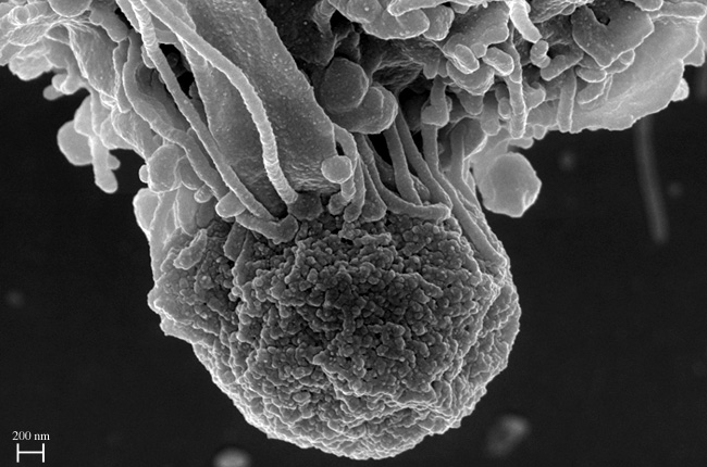 SEM Gallery | Analytical Imaging Facility | Albert Einstein College of ...